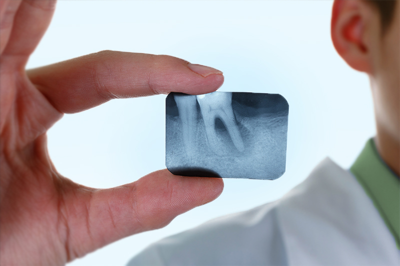 Why You Should Visit a Periodontist for Gum Disease | Dr. Jackson